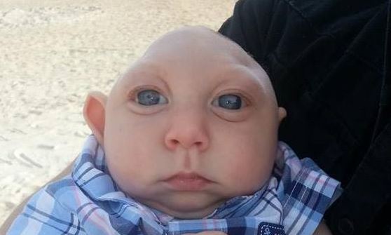 Is Baby Born Without Brain Possible? | Just-Health.net