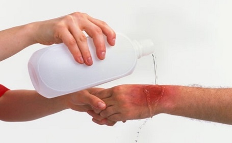 Is Toothpaste Good for Burns? Are There Better Remedies? | Just-Health.net